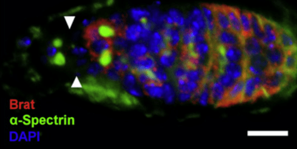 Research Background | ashe lab